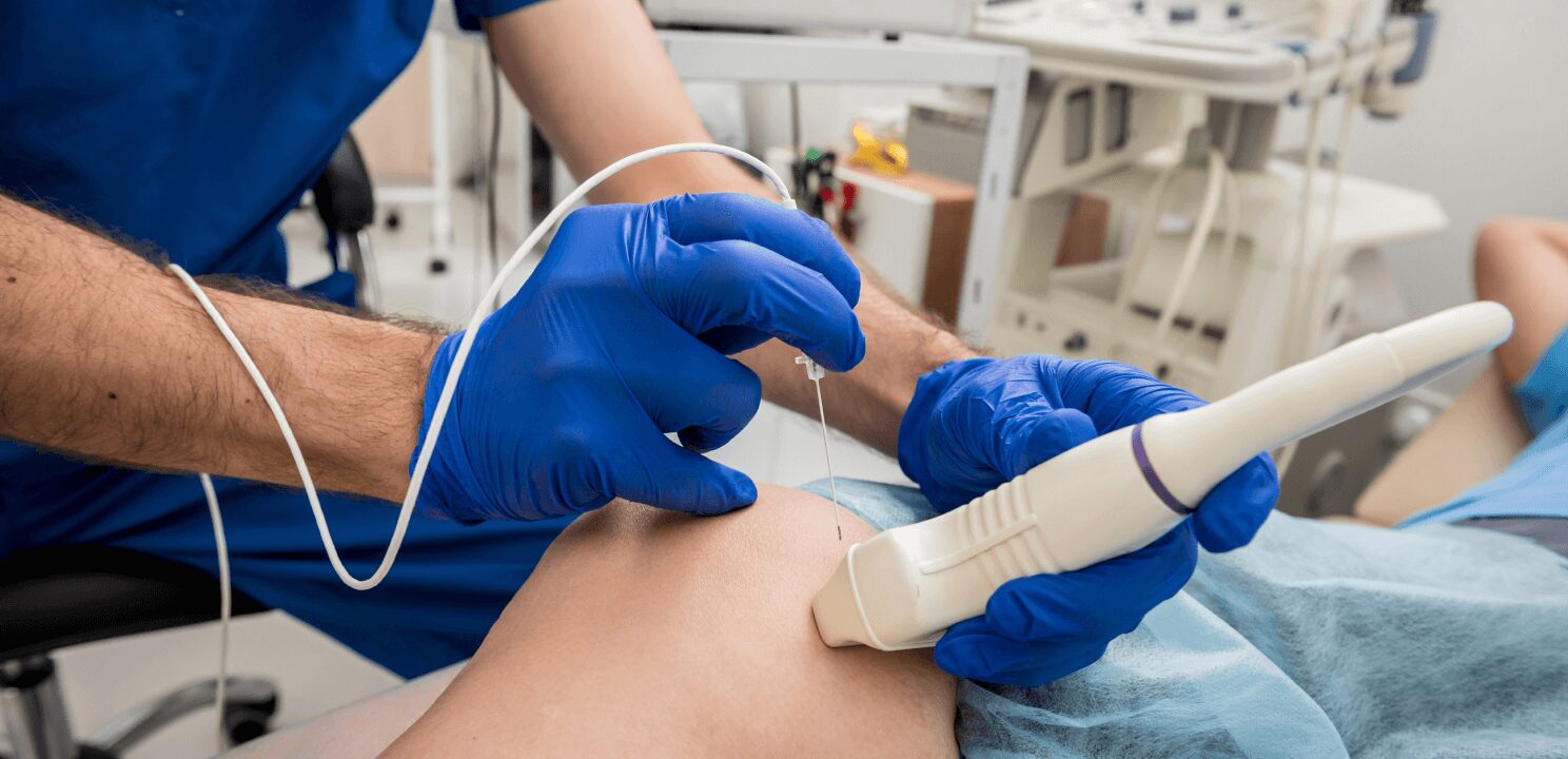 Pulsed RFA - Gramercy Beverly Hills